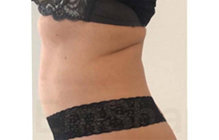 EmShapeWell - Dali Wellness